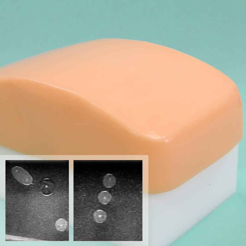 US-Sensist 神経ブロックモデル